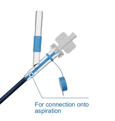 News - Suction ureteral access sheath (Product clinical knowledge)